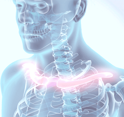 Clavicle Fracture (Collarbone Fracture) | Spine & Orthopedic Center