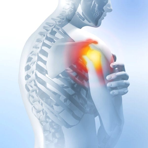 Shoulder Injury Specialists | South Florida | Spine & Orthopedic Center