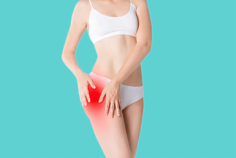 View Lump On Upper Inner Thigh PNG View Lump On Upper Inner Thigh PNG