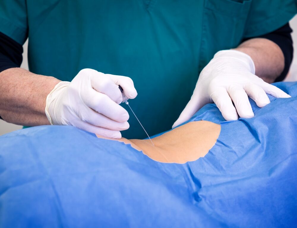 Why Do I Feel a Warm Sensation in My Thigh | Spine & Orthopedic Center