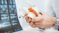 Treatment for Herniated Nucleus Pulposus | Spine & Orthopedic Center
