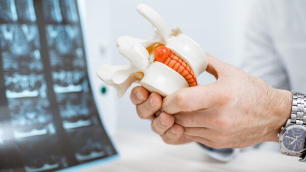 Treatment for Herniated Nucleus Pulposus | Spine & Orthopedic Center